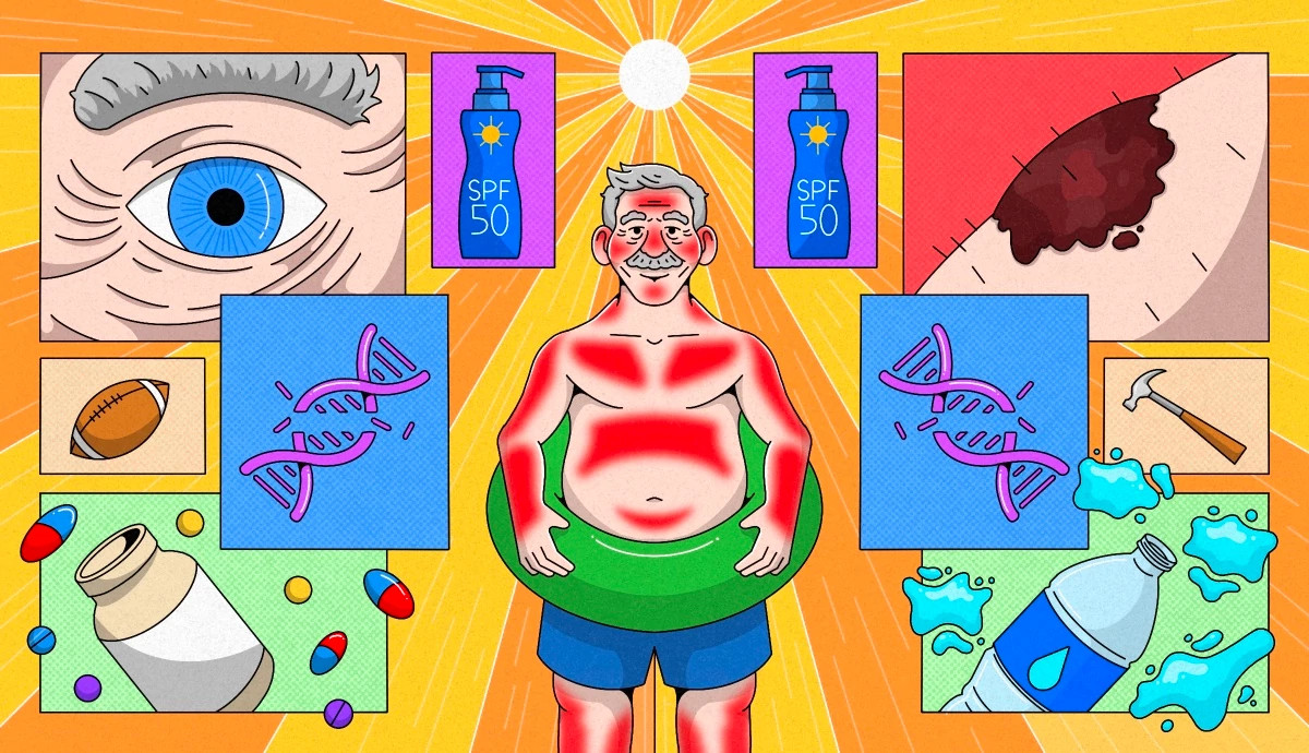 Why Even One Sunburn Matters for Older Adults
